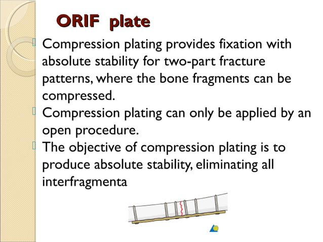 Teknik operasi orif femur | PPT