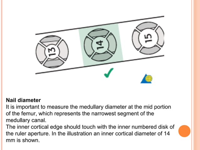 Teknik operasi orif femur | PPT
