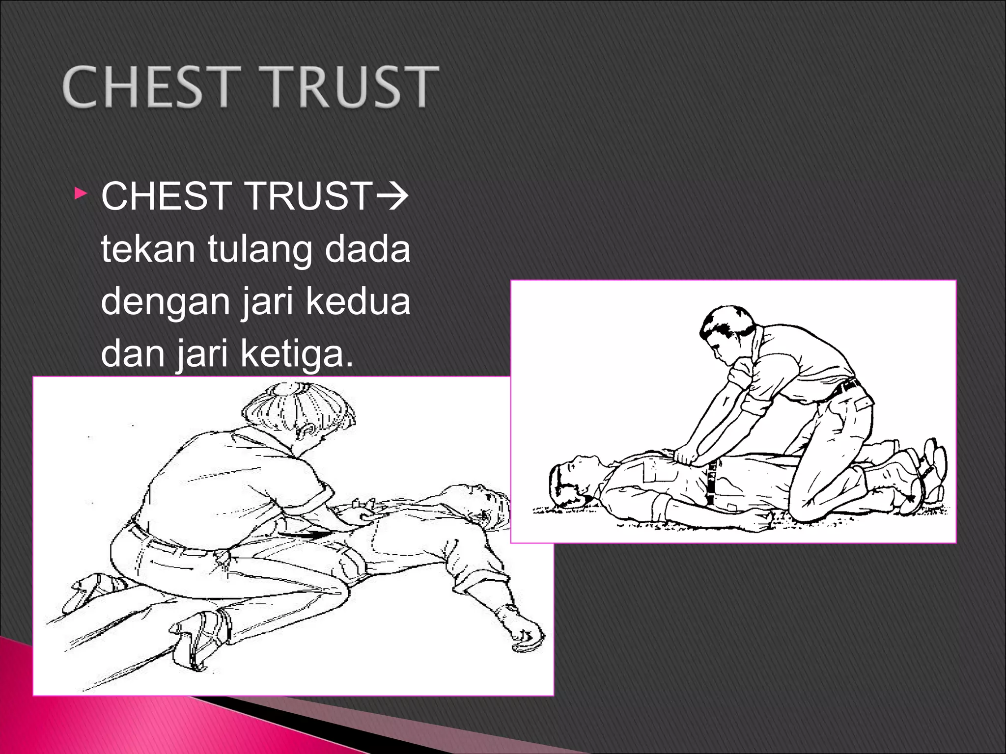 Teknik pembebasan jalan nafas | PPT