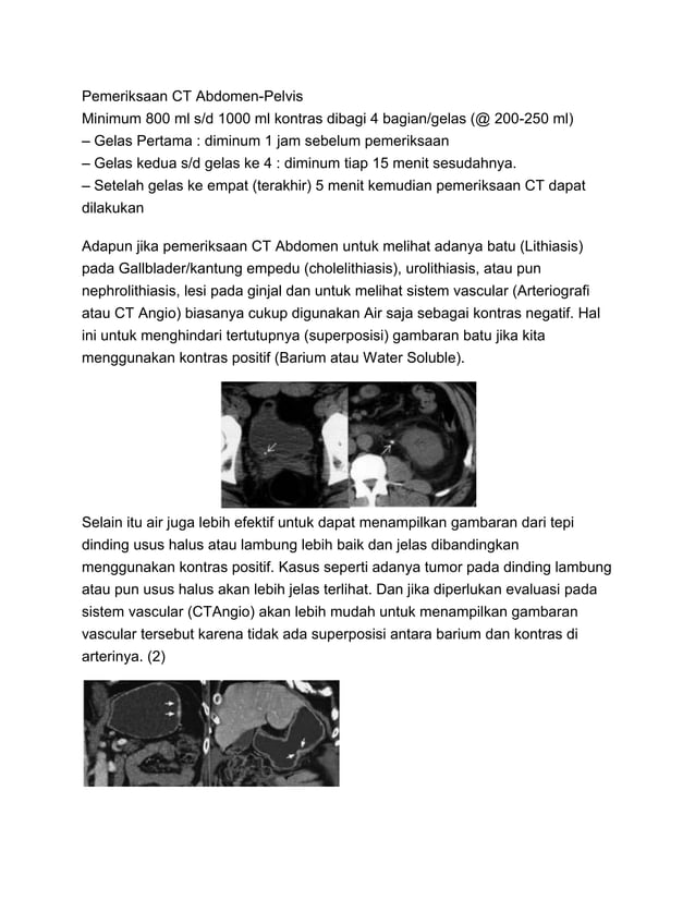 Teknik pemberian oral contrast pada pemeriksaan ct scan abdomen | DOCX