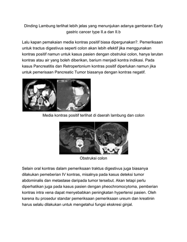 Teknik pemberian oral contrast pada pemeriksaan ct scan abdomen | DOCX