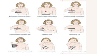 TEKNIK PEMERIKSAAN MAMOGRAFI DI RUMAH SAKIT TYPE B.pdf