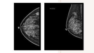 TEKNIK PEMERIKSAAN MAMOGRAFI DI RUMAH SAKIT TYPE B.pdf