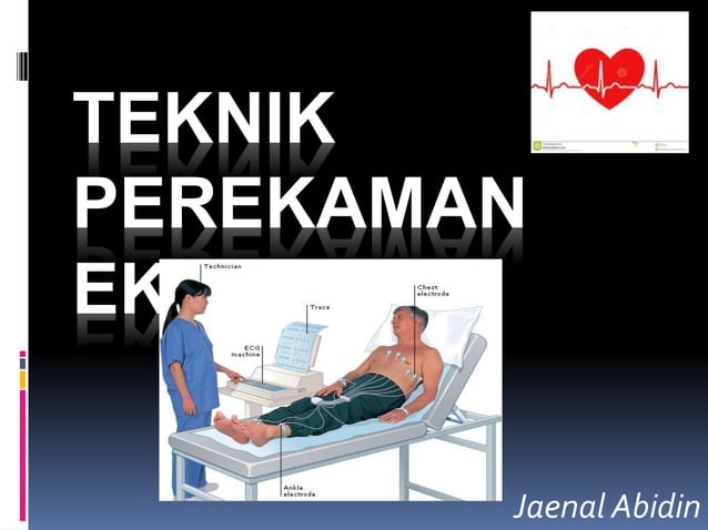 Teknik Perekaman EKG new.pptx