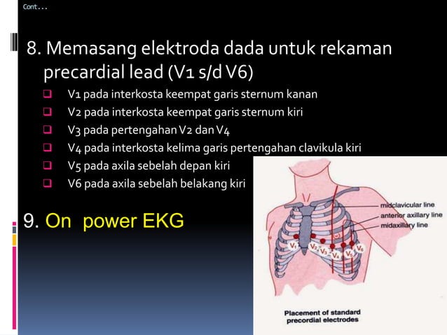 Teknik Perekaman EKG new.pptx