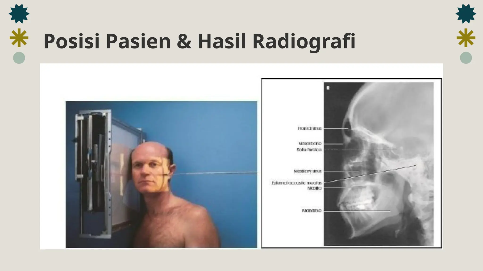 TEKNIK RADIOGRAFI DASAR CEPHALOMETRI.pptx