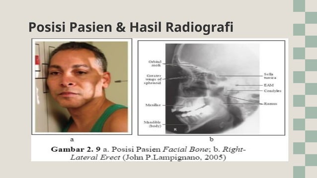 TEKNIK RADIOGRAFI DASAR CEPHALOMETRI.pptx