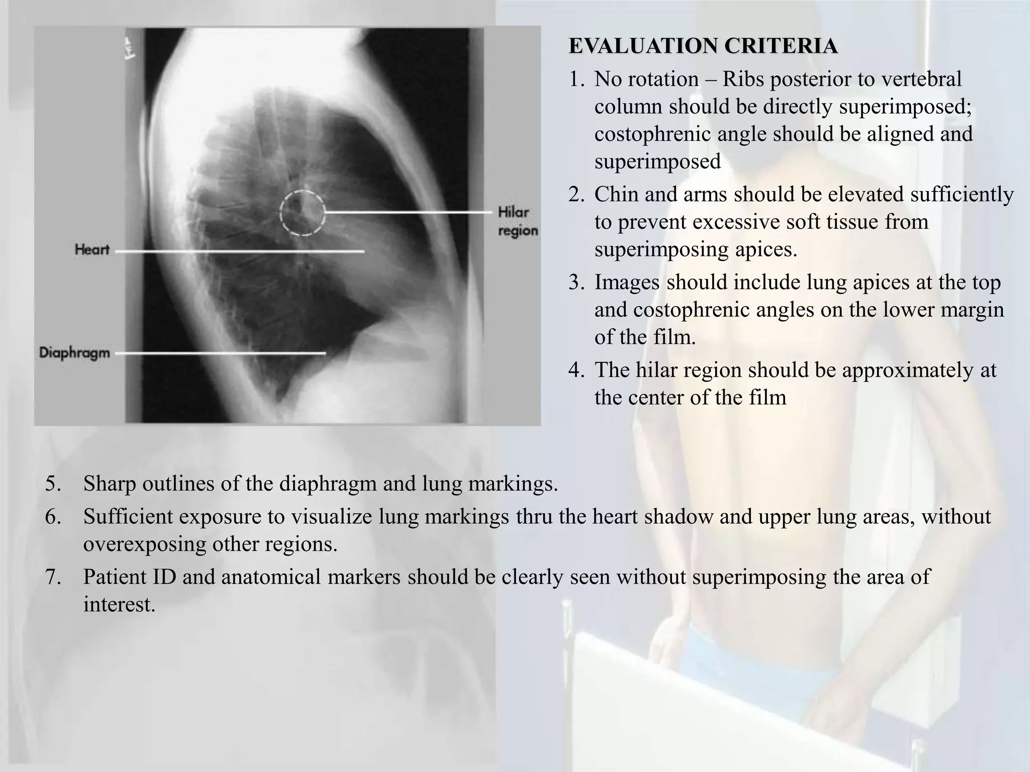 Teknik radiografi (chest xray) | PPTX