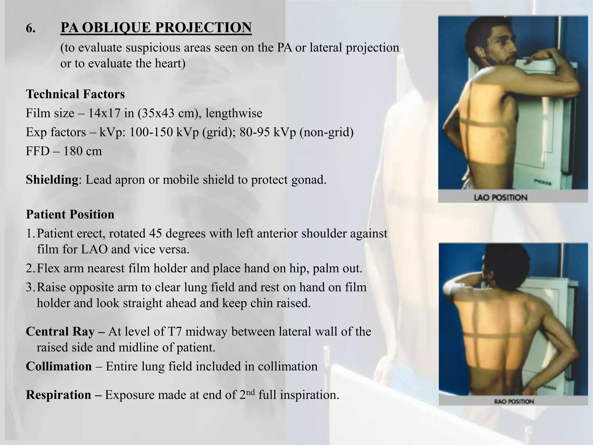 Teknik radiografi (chest xray) | PPTX