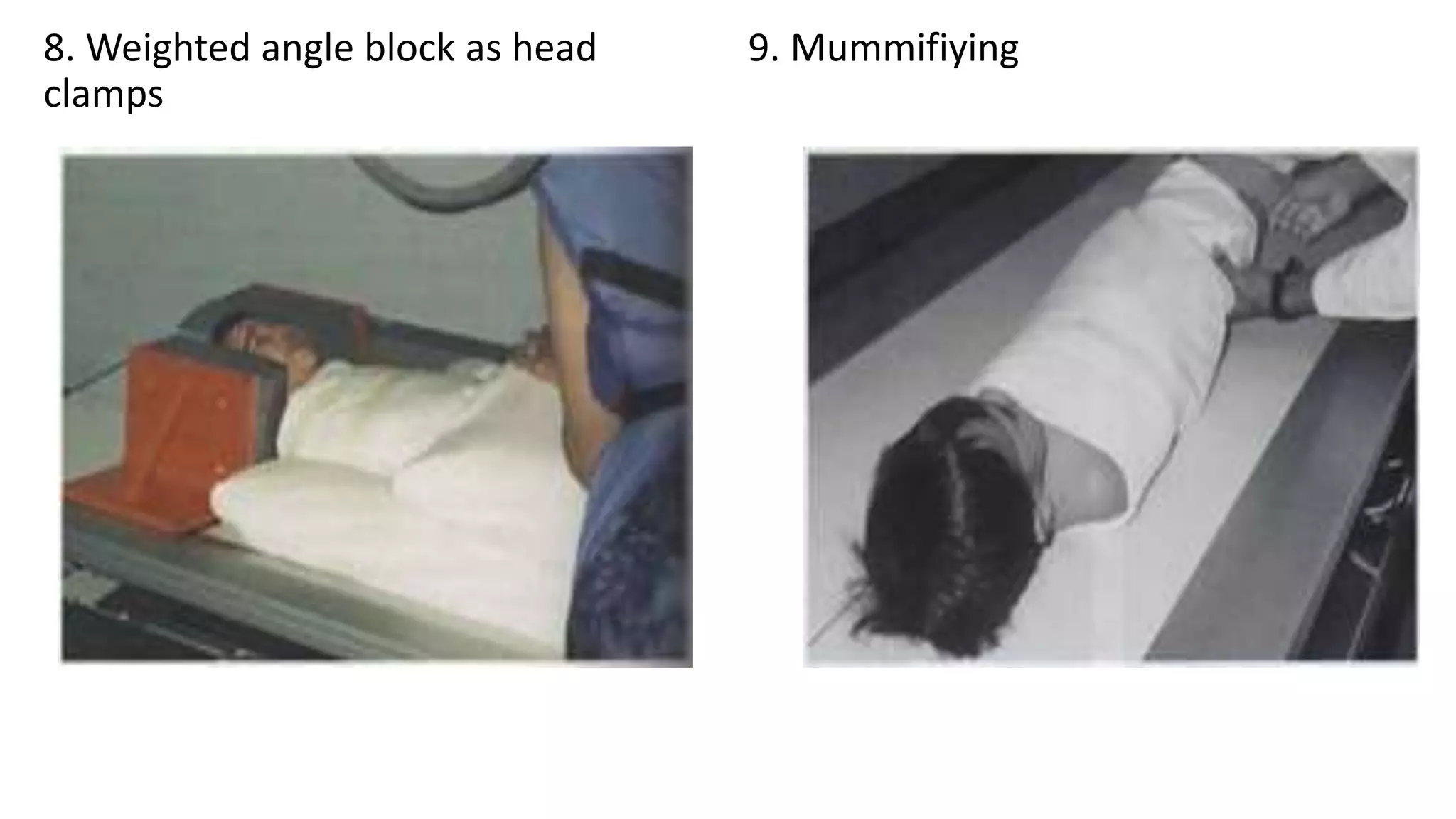 Teknik Radiografi 3 Pediatric | PPTX