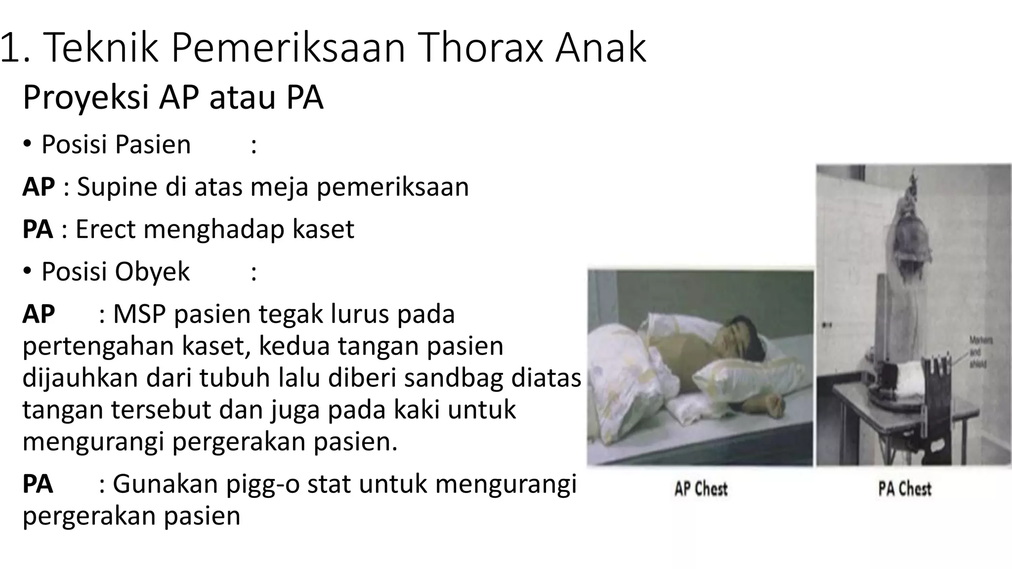 Teknik Radiografi 3 Pediatric | PPTX