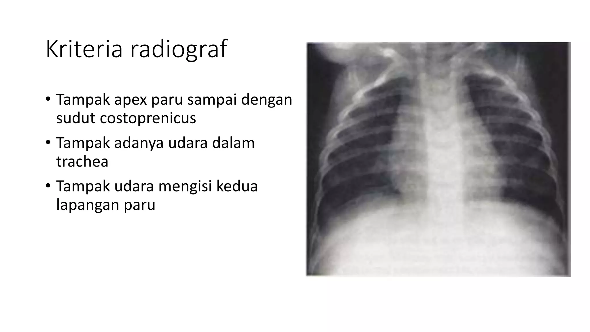 Teknik Radiografi 3 Pediatric | PPTX