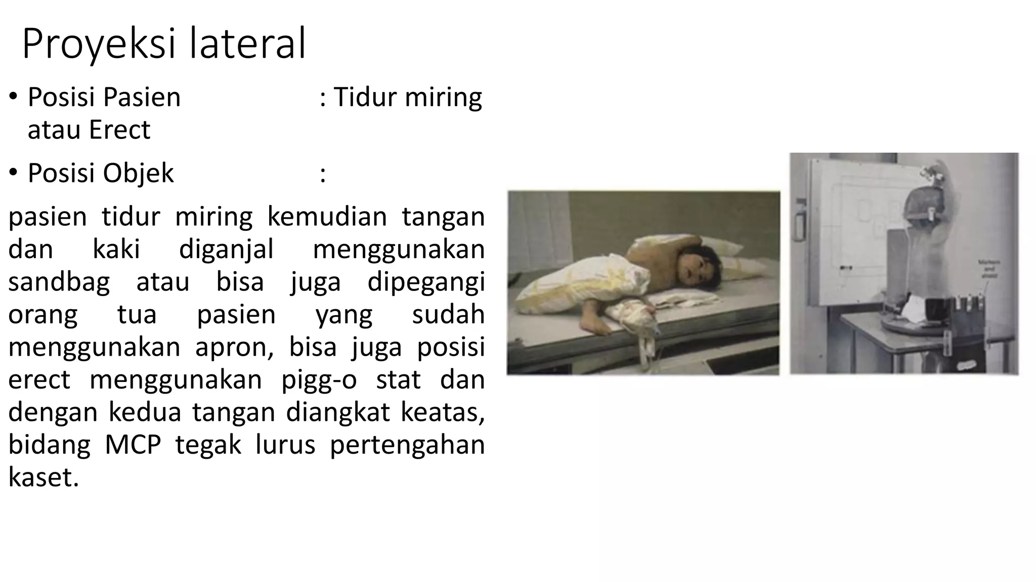 Teknik Radiografi 3 Pediatric | PPTX