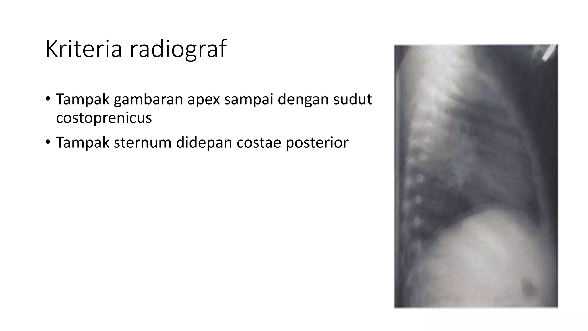 Teknik Radiografi 3 Pediatric | PPTX