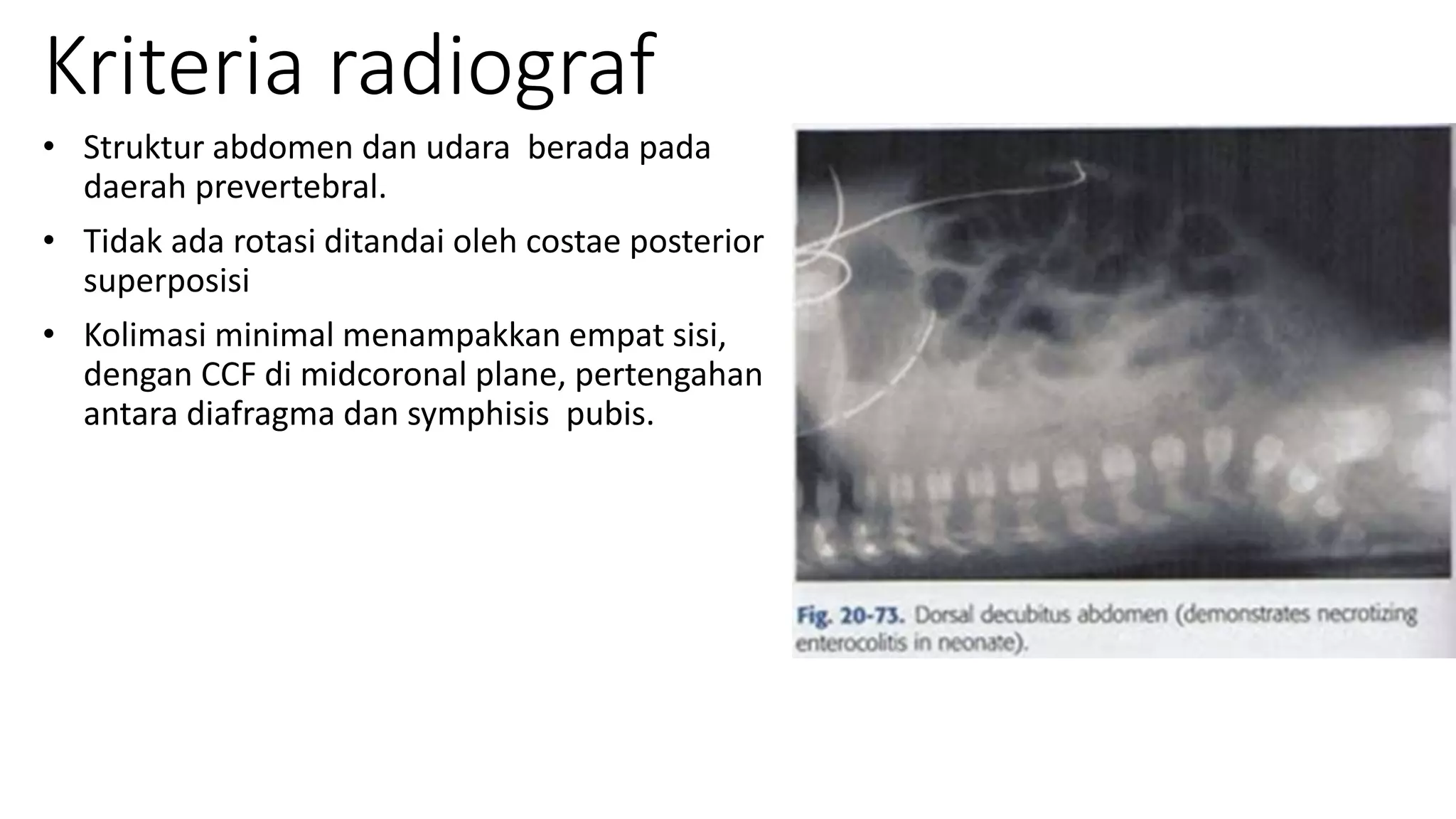 Teknik Radiografi 3 Pediatric | PPTX
