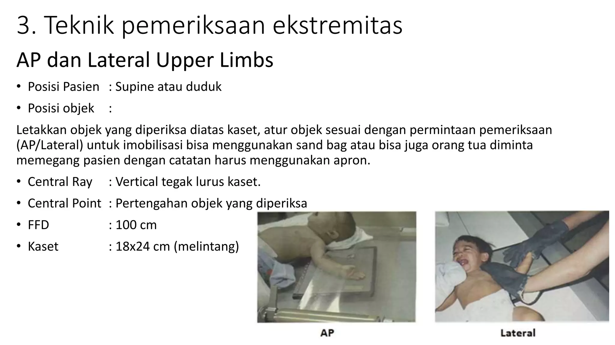 Teknik Radiografi 3 Pediatric | PPTX