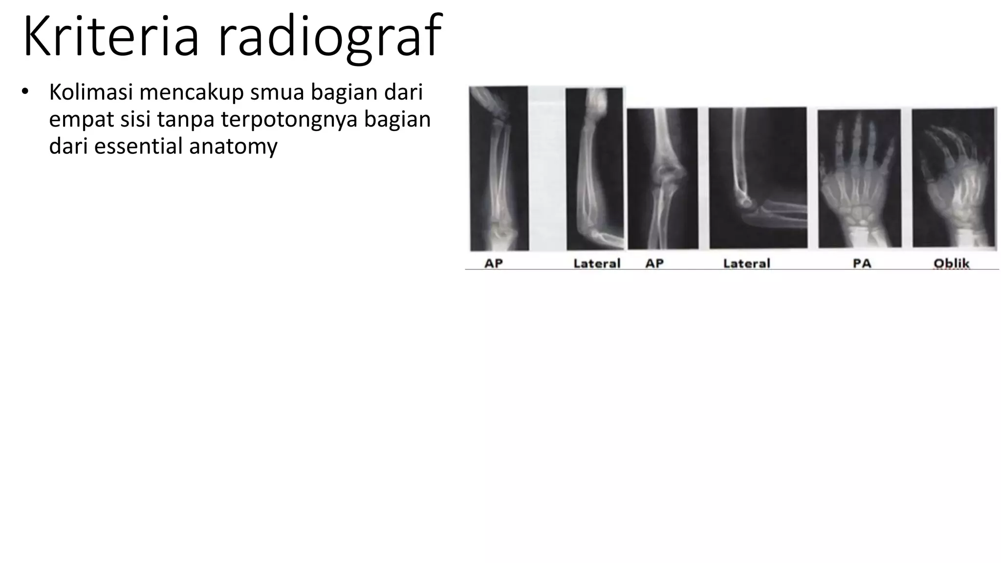 Teknik Radiografi 3 Pediatric | PPTX