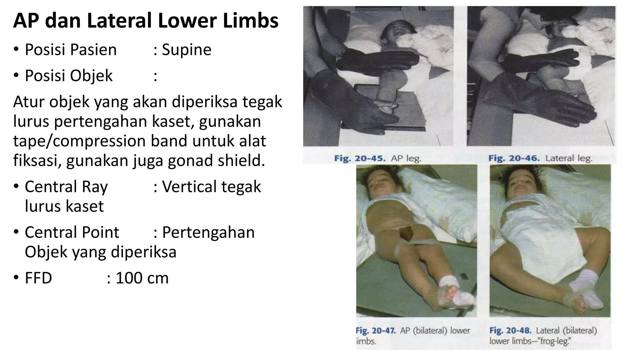 Teknik Radiografi 3 Pediatric | PPTX