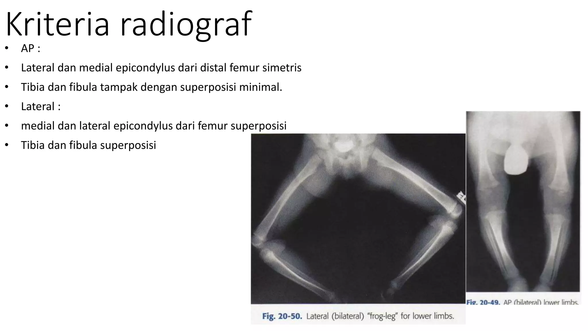 Teknik Radiografi 3 Pediatric | PPTX