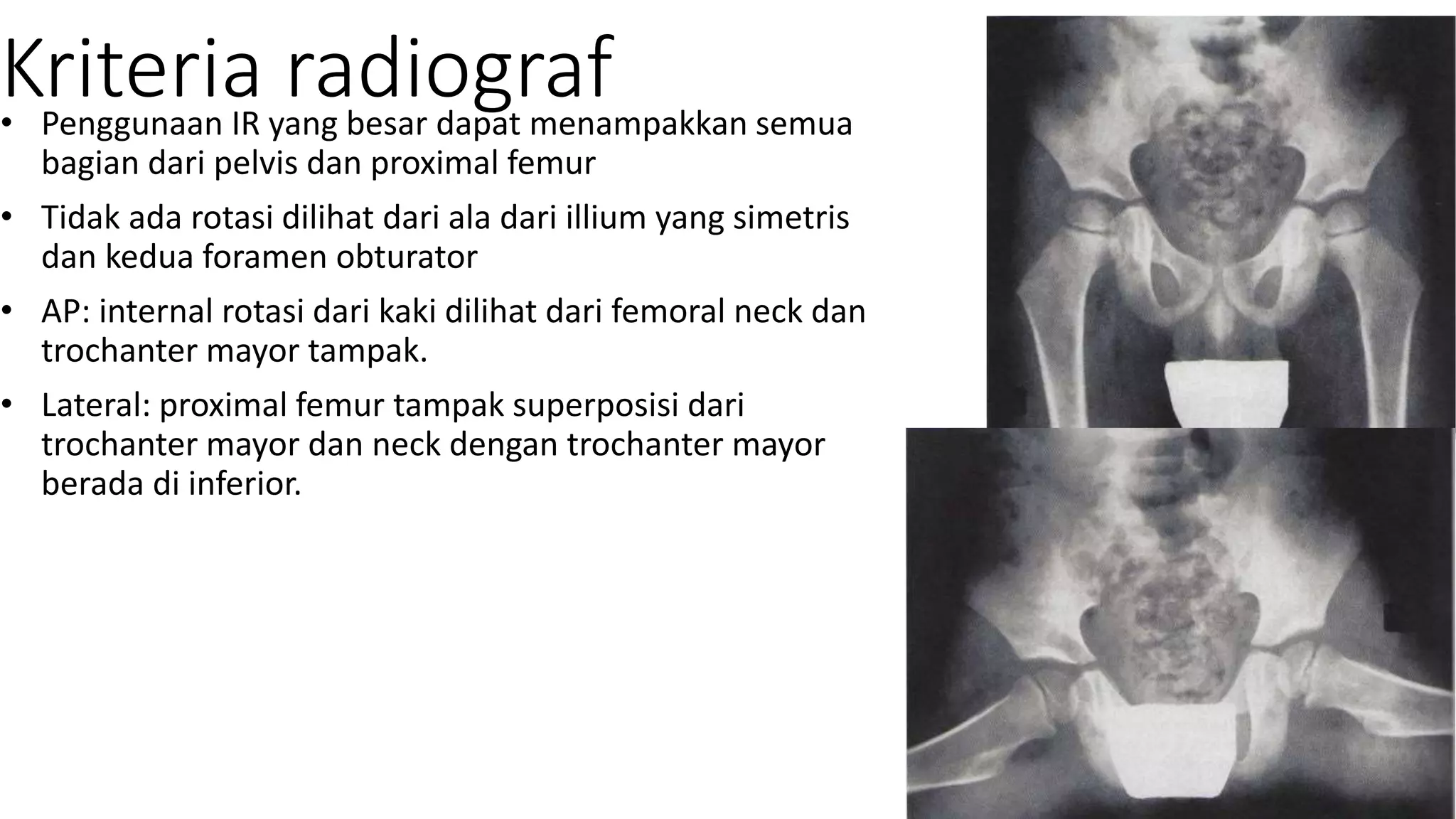 Teknik Radiografi 3 Pediatric | PPTX