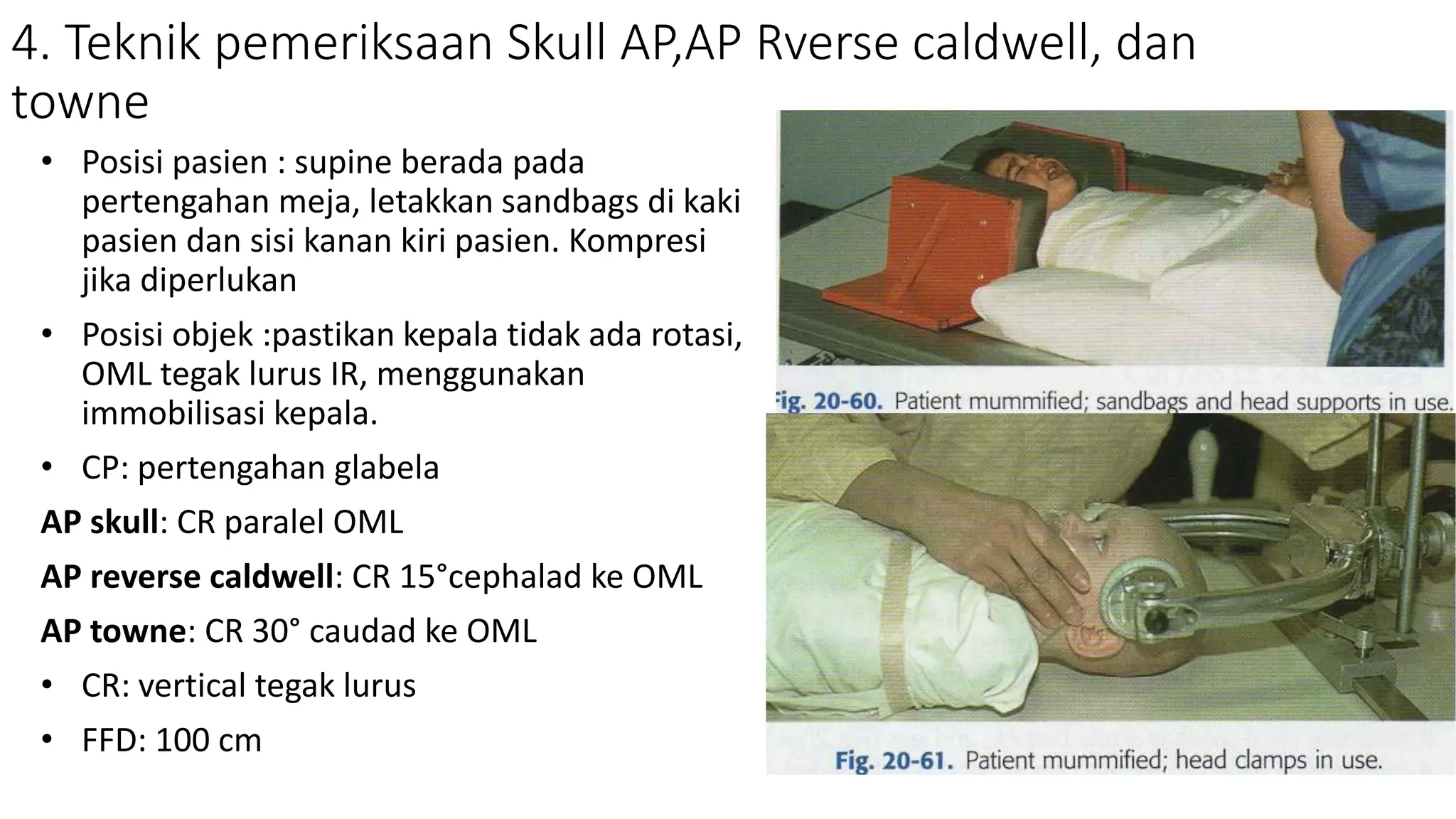 Teknik Radiografi 3 Pediatric | PPTX