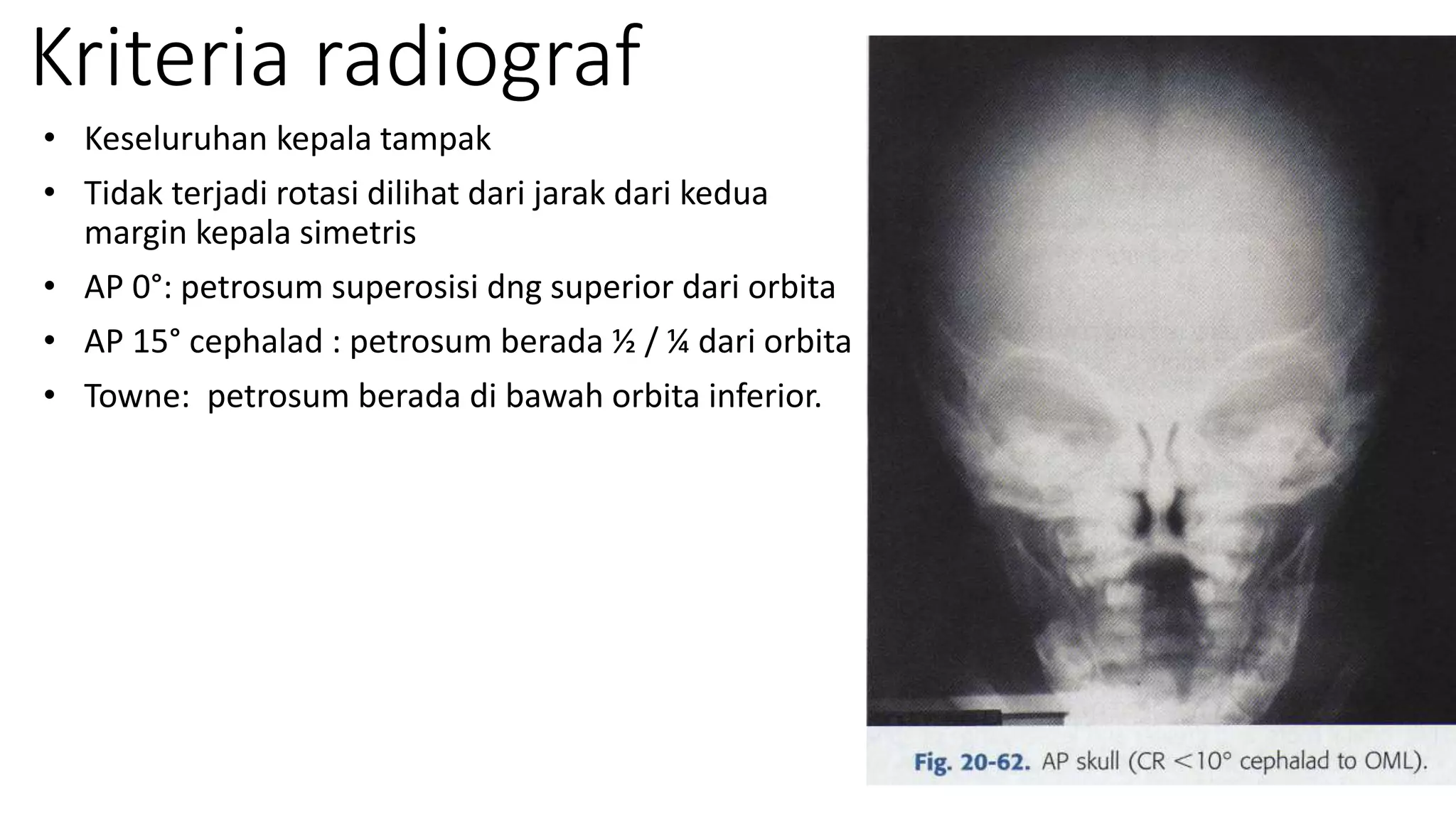 Teknik Radiografi 3 Pediatric | PPTX
