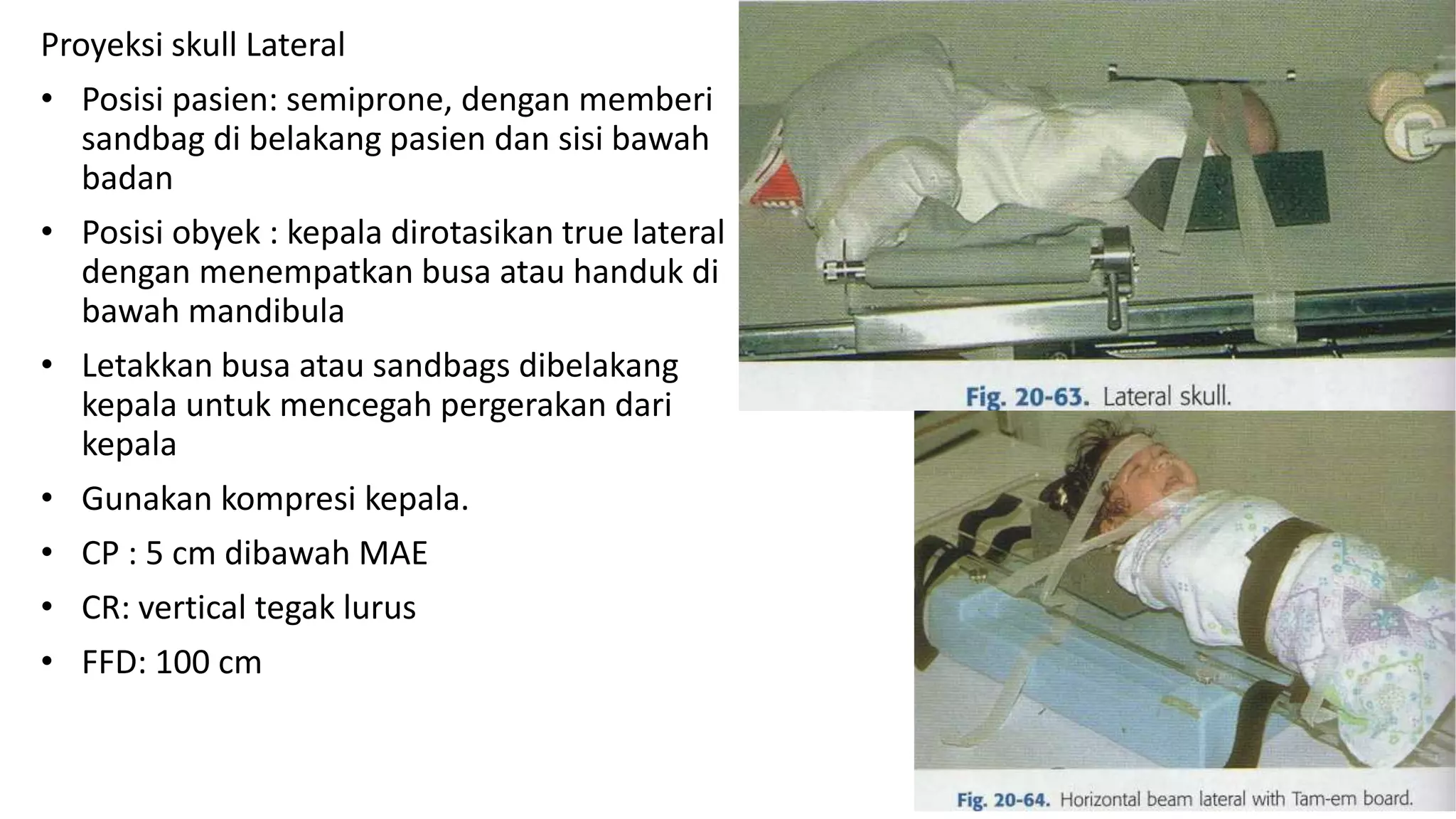 Teknik Radiografi 3 Pediatric | PPTX