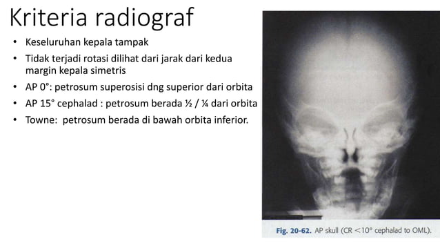 Teknik Radiografi 3 Pediatric | PPTX