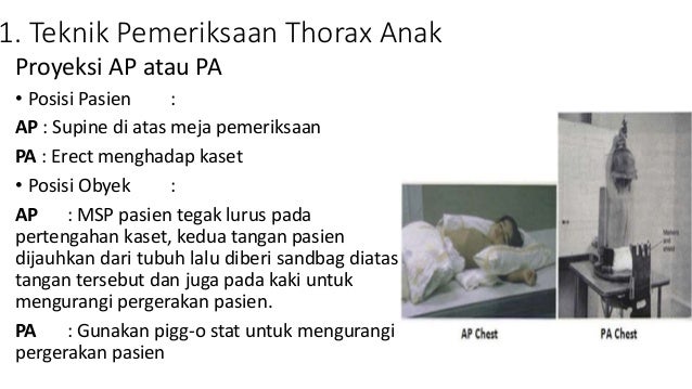 Teknik Radiografi 3 Pediatric