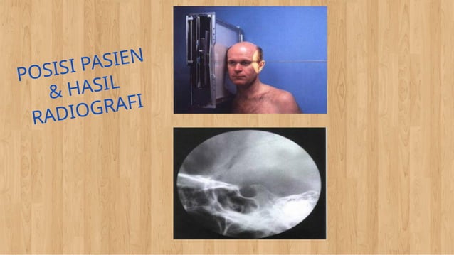 TEKNIK RADIOGRAFI DASAR SELLA TURSICA.pptx