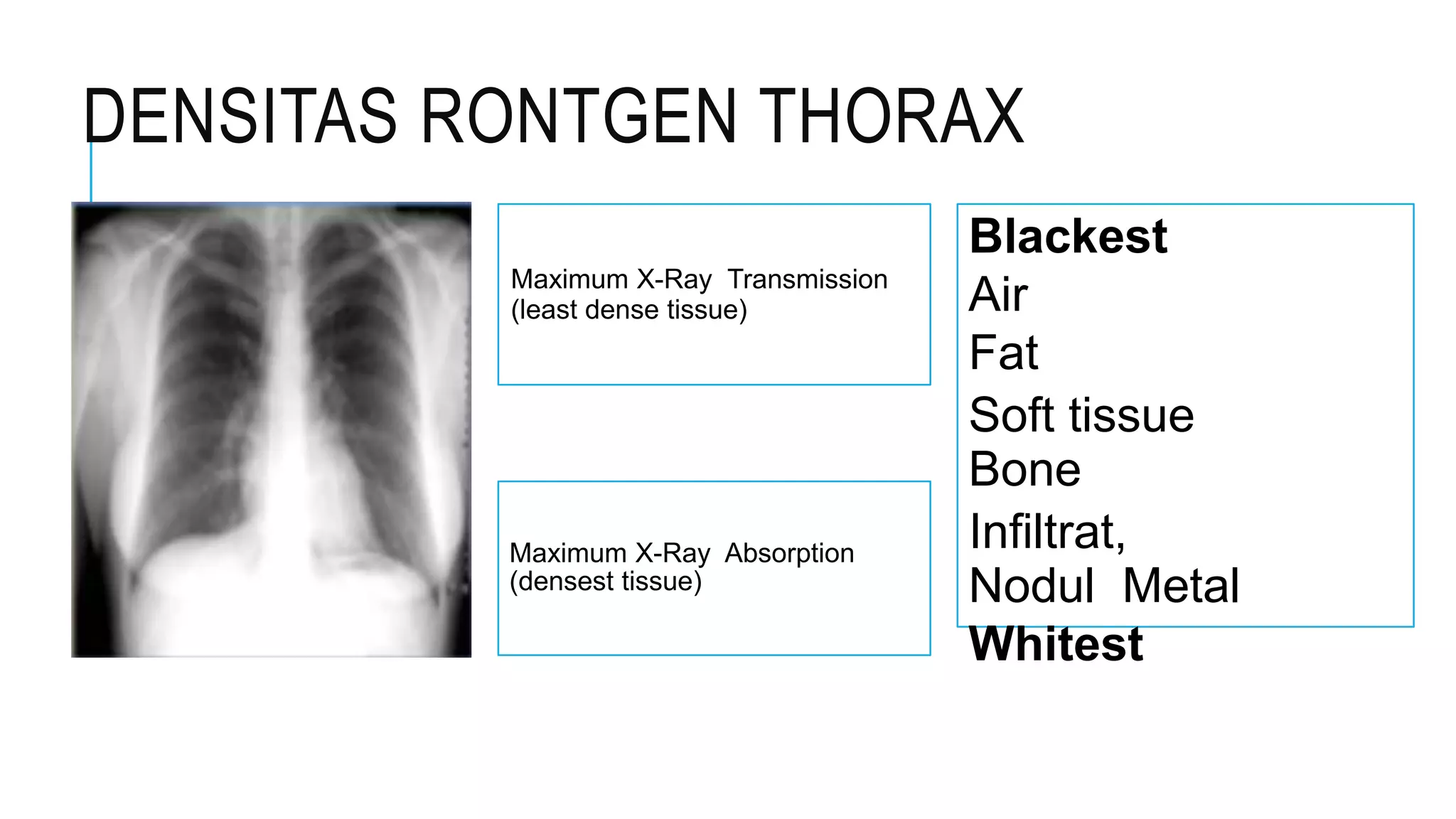 Teknik Radiografi Thoraks.pptx