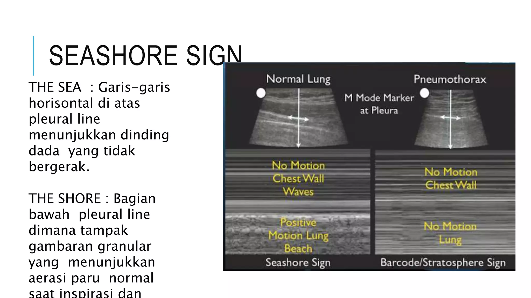 Teknik Radiografi Thoraks.pptx
