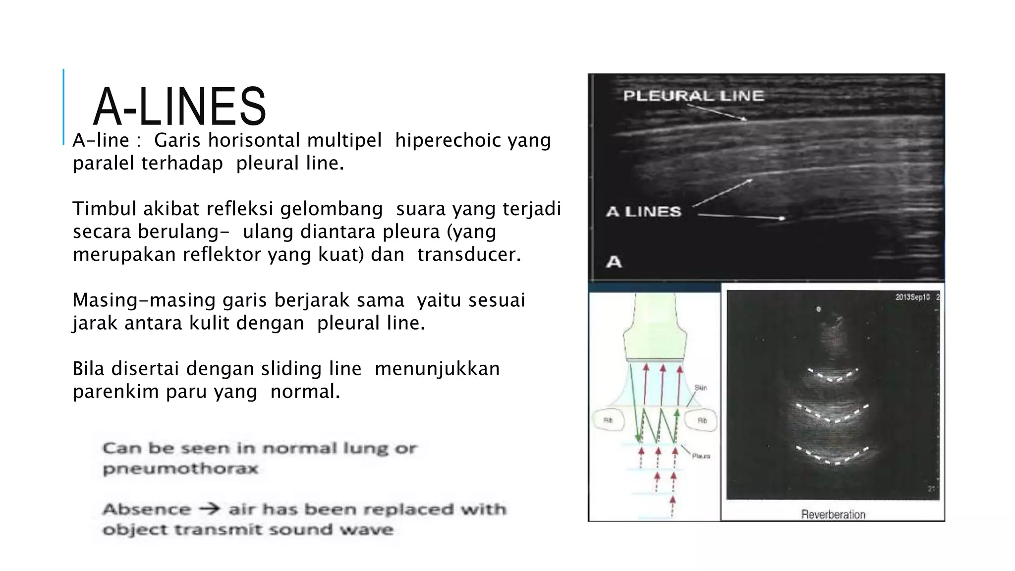 Teknik Radiografi Thoraks.pptx