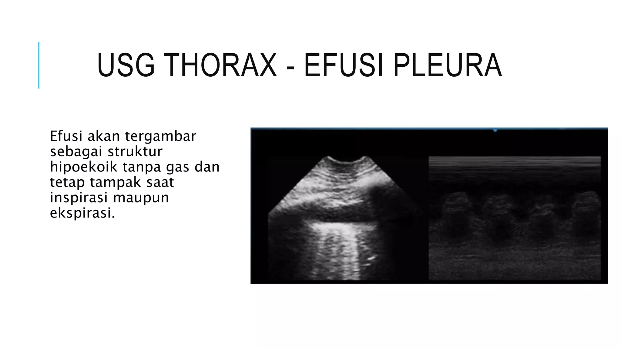 Teknik Radiografi Thoraks.pptx