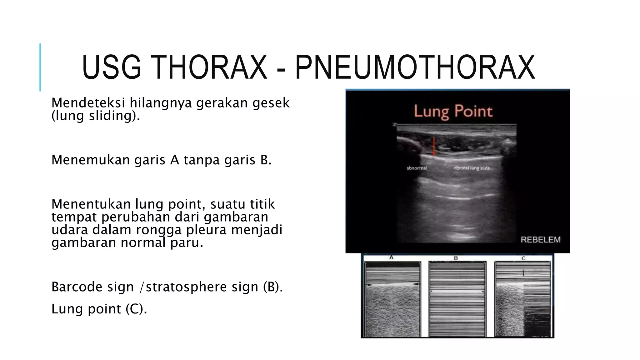 Teknik Radiografi Thoraks.pptx