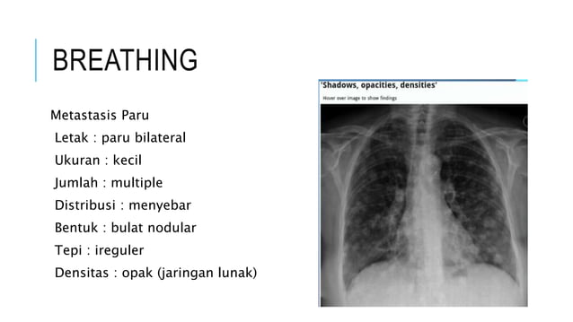 Teknik Radiografi Thoraks.pptx