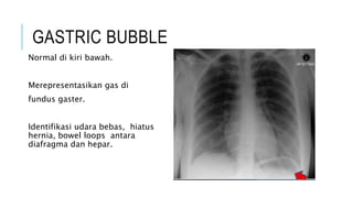 Teknik Radiografi Thoraks.pptx