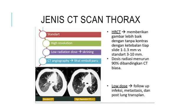 Teknik Radiografi Thoraks.pptx