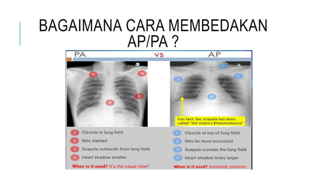 Teknik Radiografi Thoraks.pptx