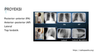 Teknik Radiografi Thoraks.pptx