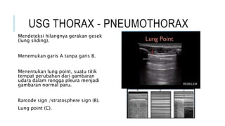 Teknik Radiografi Thoraks.pptx