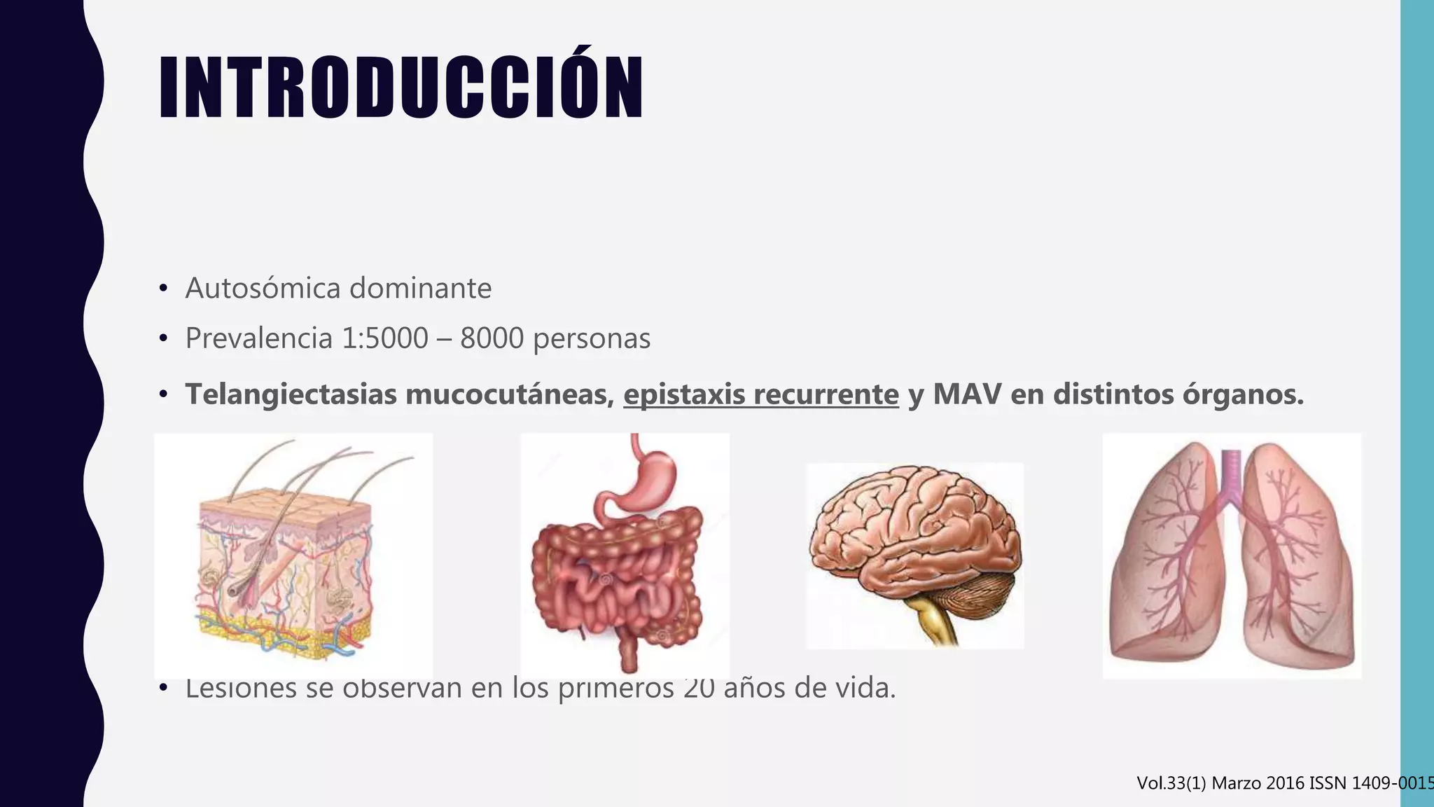 Telangiectasia hemorrágica hereditaria | PPTX