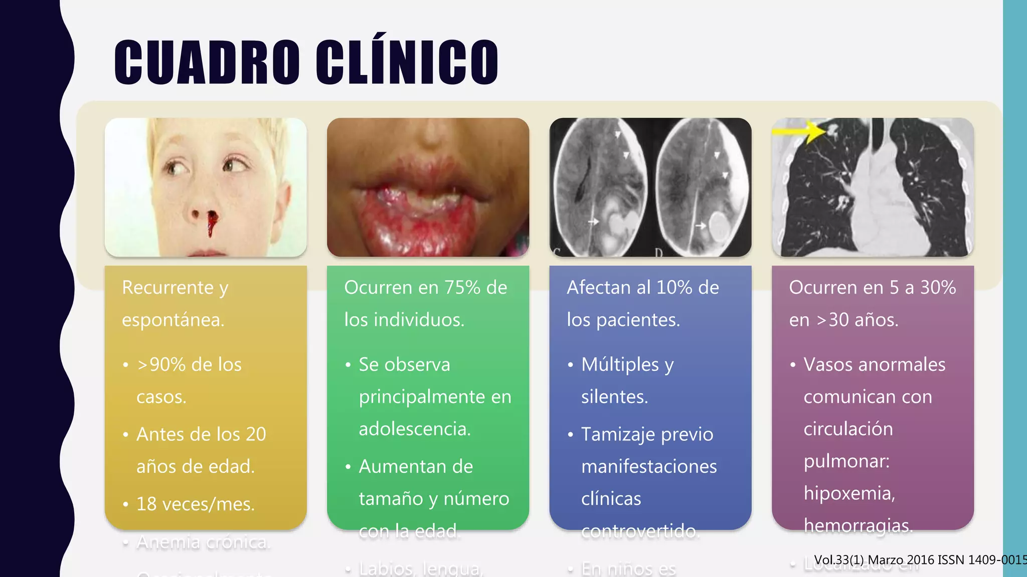 Telangiectasia hemorrágica hereditaria | PPTX