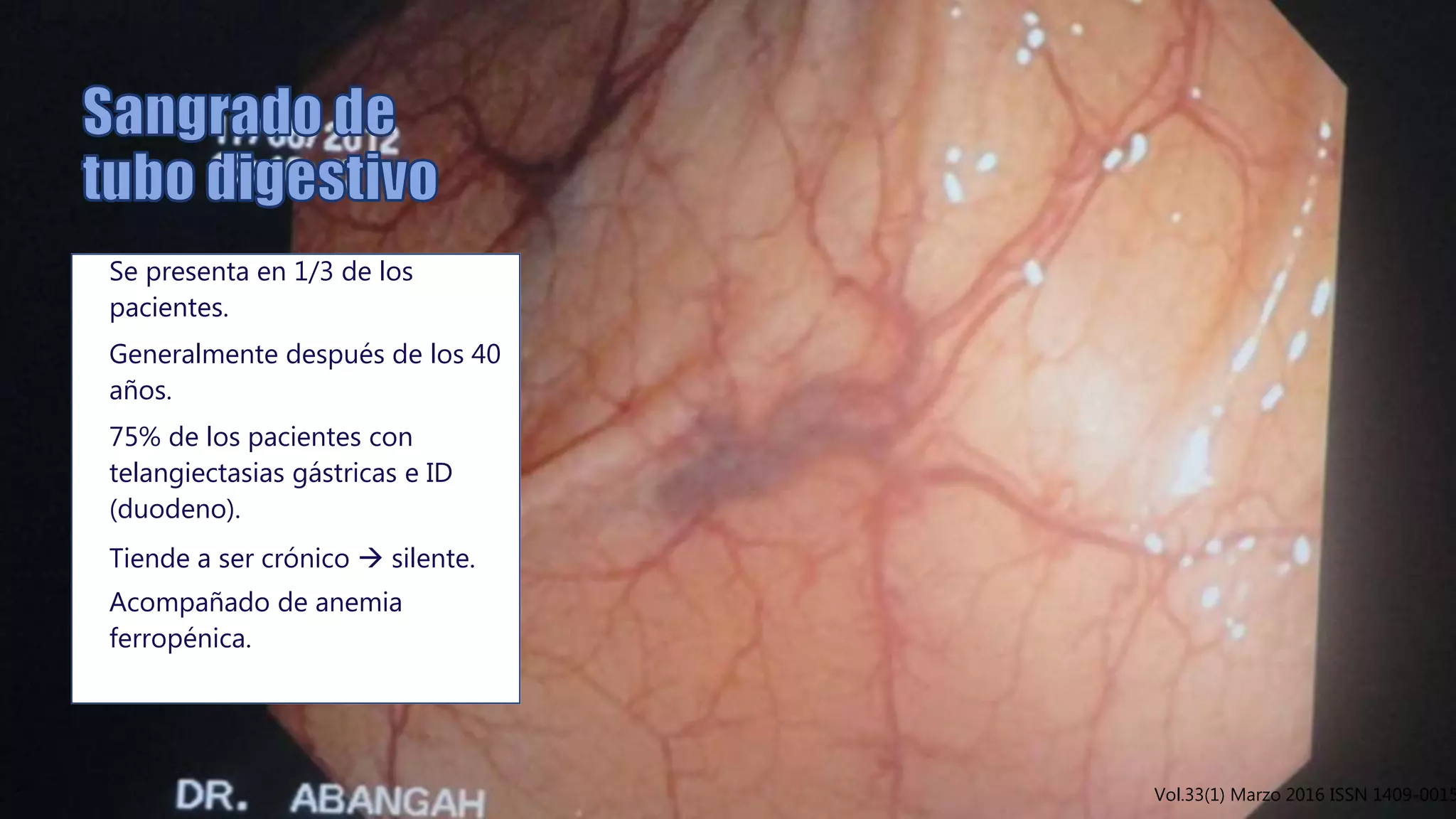 Telangiectasia hemorrágica hereditaria | PPTX