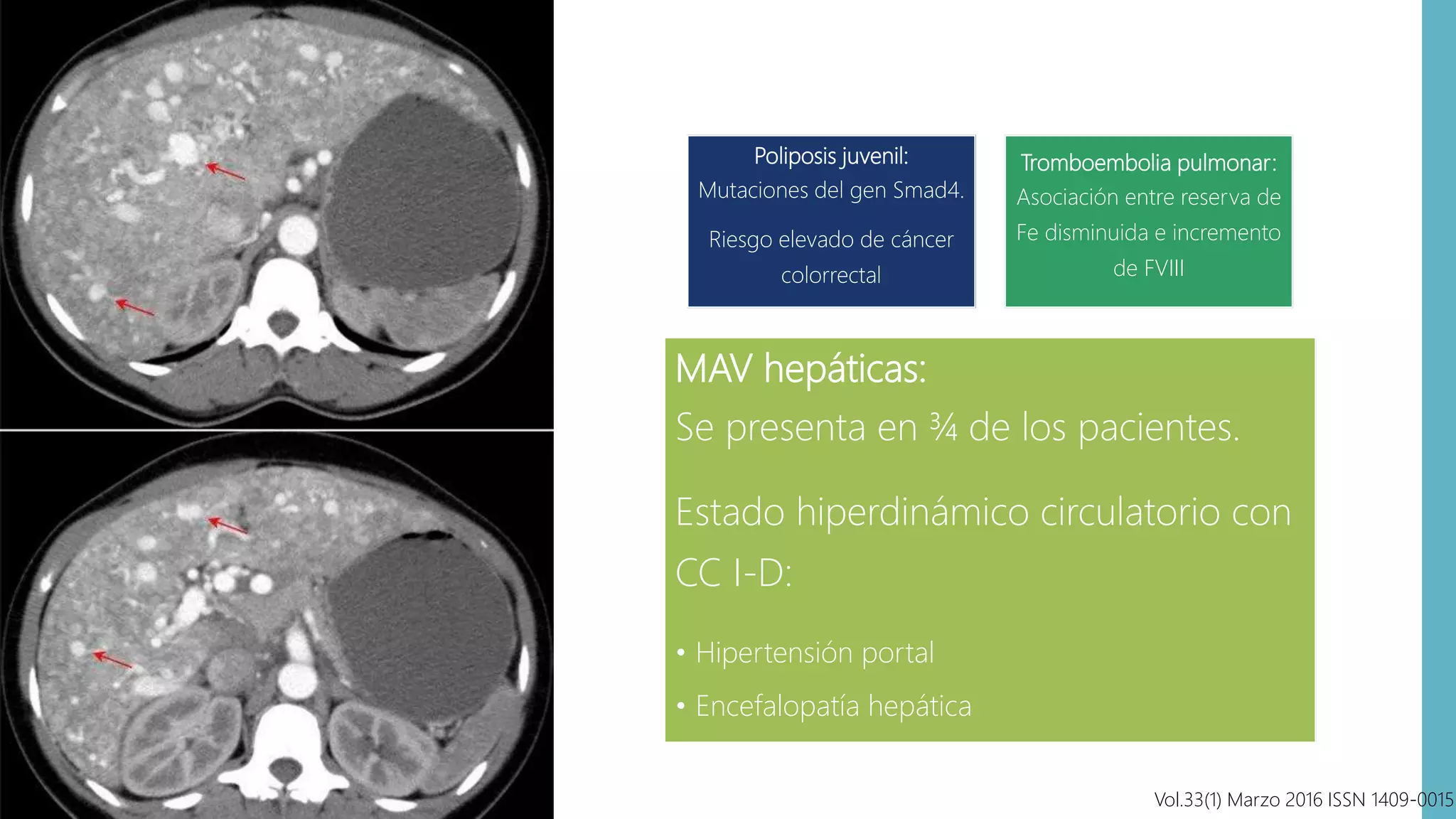 Telangiectasia hemorrágica hereditaria | PPTX