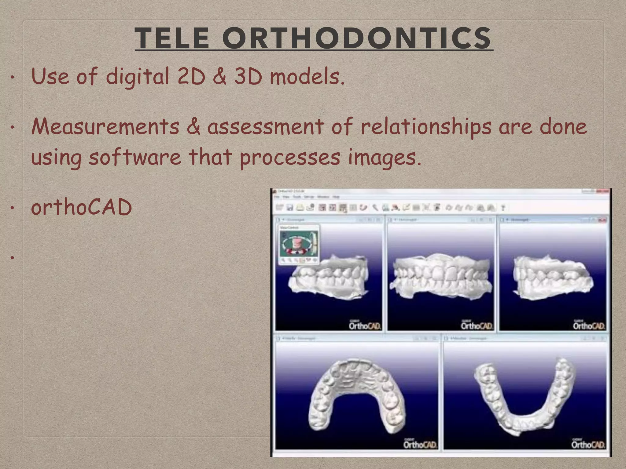 Teledentistry - a review | PDF