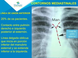 Radiología del Aparato Respiratorio | PPTX