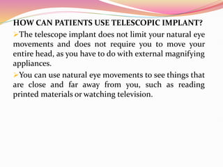 Telescopic eye implant in optometry profession | PPT