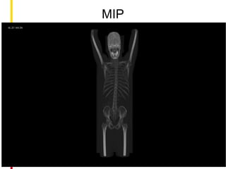 Cloud Based Teleradiology Solution from MedPac Systems | PPT