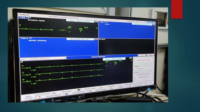 Telemetry Monitoring.pptx